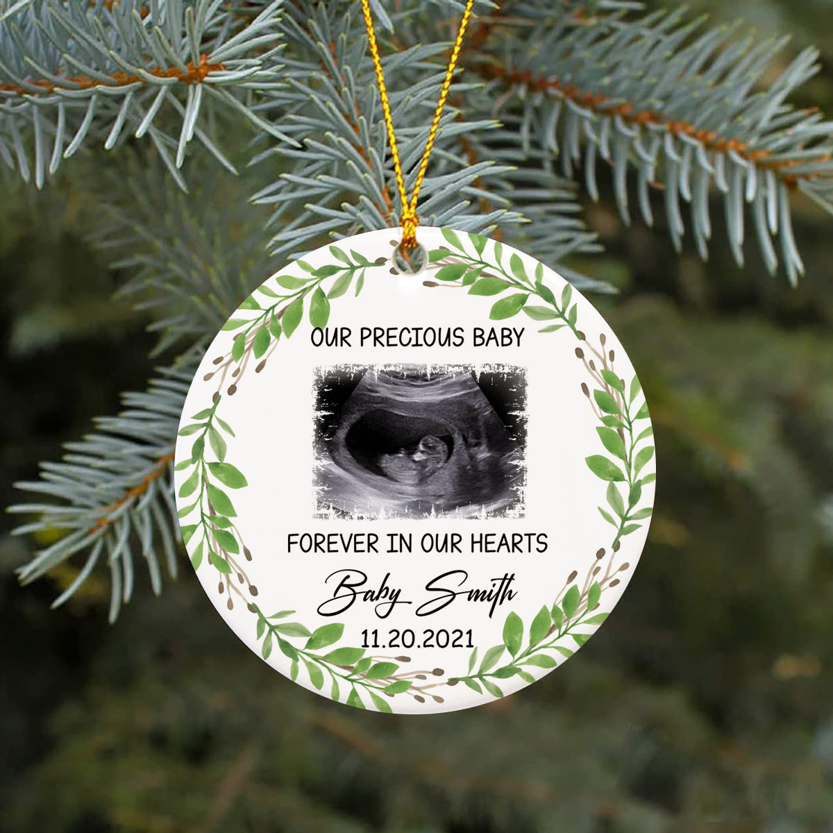 Miscarriage Memorial Ornament - Custom Sonogram Photo, Remembrance for ...